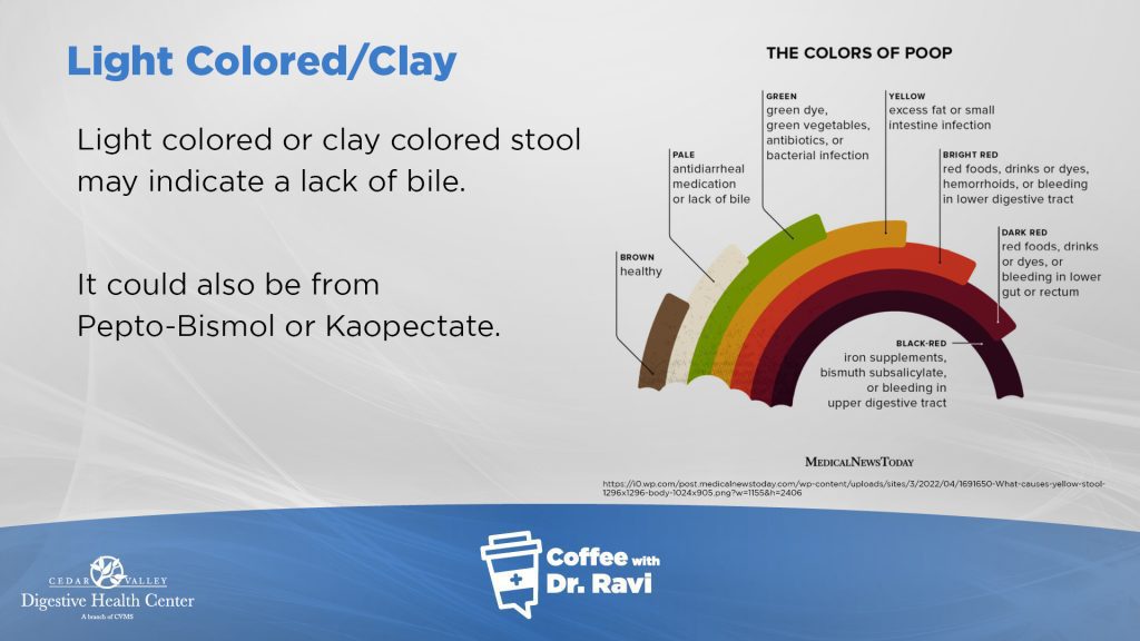 Coffee with Dr. Ravi #72: When to Worry About Stool Color - Cedar ...